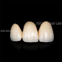 China Custom Layered Zirconia Perfect Shade Matching for Front Teeth Cosmetics for sale