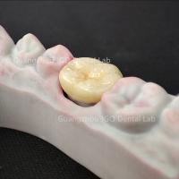China Trusted Chinese Dental Lab Supply High-Quality Monolithic Zirconia Natural Look Long Service Life for sale