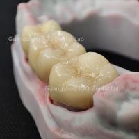 China Natural Looking Layered Zirconia Restoration High Durability Dental Lab Fast Production for sale