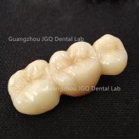 China Ultra Strong Zirconia Crown Bridge Stable Structure For Posterior Restoration for sale