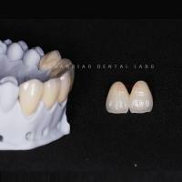 China Aesthetic Layered  Monolithic Bulk Zirconia Customizable to Your Clinic Needs for sale