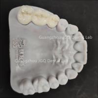China Zirconia Crown Bridge Dental Laboratory China High Accuracy CE FDA ISO Standard for sale