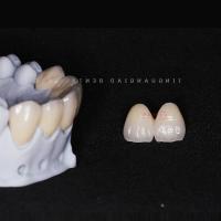 China Esthetic High Precision Zirconia Crowns Bridges CNC Milled Fast Deliver for sale