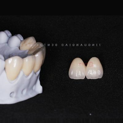 China Esthetic High Precision Zirconia Crowns Bridges CNC Milled Fast Deliver for sale