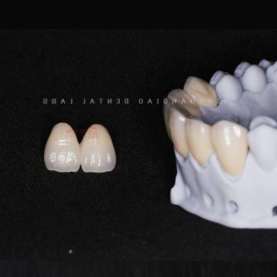 China Zirconia Crown Bridge Dental Laboratory China High Accuracy CE FDA ISO Standard for sale