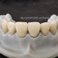 China 3 Shape Lifelike Zirconia Crown Bridge Seamless Integration With Natural Dentition CAD CAM for sale