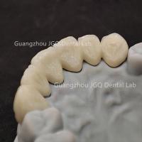 China 3 Shape Lifelike Zirconia Crown Bridge Seamless Integration With Natural Dentition CAD CAM for sale