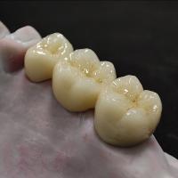 China Zirconia Crown Bridge Dental Laboratory China High Accuracy CE FDA ISO Standard for sale
