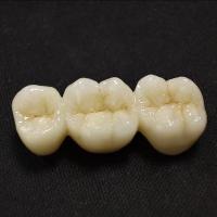 China Ultra Strong Zirconia Crown Bridge Stable Structure For Posterior Restoration for sale
