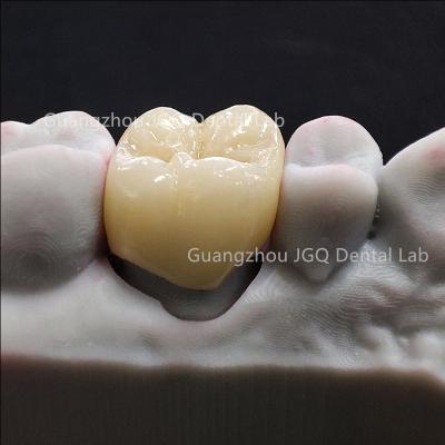 China 3Shape CAD CAM zirconia milling Guangzhou Dental Lab Custom Layered & Monolithic Zirconia Supply for sale