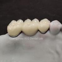 China China Dental Artificial Teeth Pfm Dental Metal Ceramic Crown Bridge Customized for sale