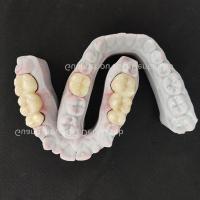 China Hypoallergenic Zirconia Crown Bridge For Permanent Dental Implants for sale