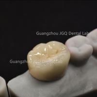 China Custom Dental Lab Zirconia Crown Bridge Full Anatomical Design High Accuracy Quick Delivery for sale
