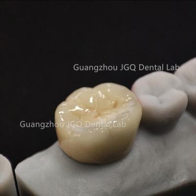 China Custom Dental Lab Zirconia Crown Bridge Full Anatomical Design High Accuracy Quick Delivery for sale