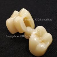 China Long Lasting Zirconia Crown Bridge Precise Margin Adaptation for Dental Restoration for sale