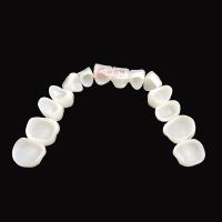China Professional Guangzhou Dental Manufacturer Premium Zirconia Solutions High Aesthetic  Anterior Smile Design for sale
