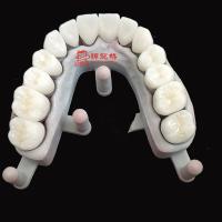 China Durable Layered Zirconia Bridge High Precision Custom Dental Lab Certified Quality for sale
