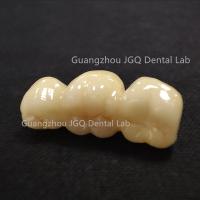 China Monolithic Zirconia Crowns Dentures CAD/CAM 1200 MPa Flexural Strength for Dental Bridges for sale