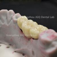 China Monolithic Zirconia Crowns Dentures CAD/CAM 1200 MPa Flexural Strength for Dental Bridges for sale