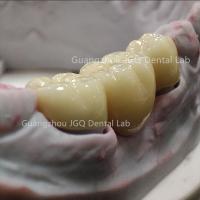 China Monolithic Zirconia Crowns Dentures CAD/CAM 1200 MPa Flexural Strength for Dental Bridges for sale