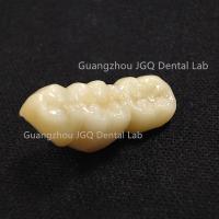 China Custom Zirconia Crown and Bridge Dental Lab CAD / CAM 1200 MPa Flexural Strength for sale