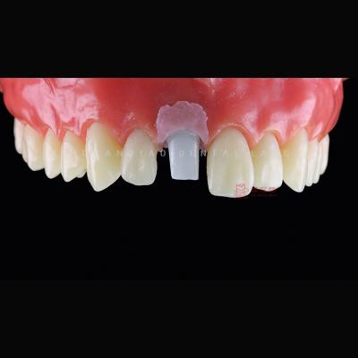 China Custom China Dental Lab Milling Service Titanium Zirconia Dental Implants Abutment for sale