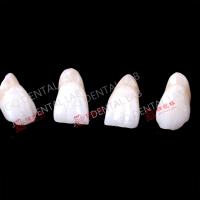 China OEM Zirconia Crown Dentures China Dental Lab Outsourcing CE FDA Certified for sale