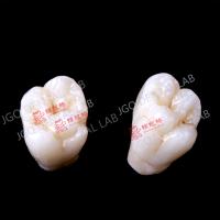 China OEM Zirconia Crown Dentures China Dental Lab Outsourcing CE FDA Certified for sale