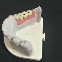 China Zirconia or Pfm Dental Implant Screw Retained Crown and Bridge for sale