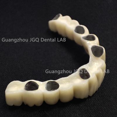China Long Bridge Pfm Porcelain Fused To Metal Crown Dentures Cobalt Chrome Alloy for sale