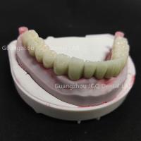 China Pfm Teeth Crowns Porcelain Fused To Metal Cobalt Chrome Alloy for sale