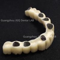 China Pfm Teeth Crowns Porcelain Fused To Metal Cobalt Chrome Alloy for sale