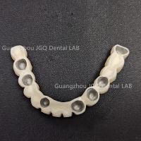 China Pfm Teeth Crowns Porcelain Fused To Metal Cobalt Chrome Alloy for sale