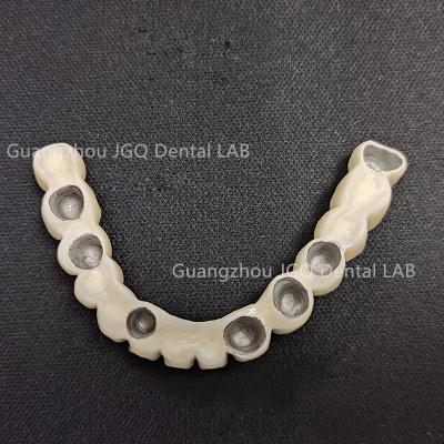 China Pfm Teeth Crowns Porcelain Fused To Metal Cobalt Chrome Alloy for sale