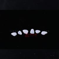 China Digital Empress Denture Porcelain Emax Veneers by Dental Prosthesis Laboratory for sale