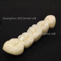 China China Dental Lab Full Metal Pfm Crowns and Bridges 3D Digital for Dental Clinics for sale