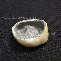 China China Dental Lab Full Metal Pfm Crowns and Bridges 3D Digital for Dental Clinics for sale