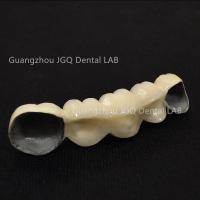 China China Dental Lab Full Metal Pfm Crowns and Bridges 3D Digital for Dental Clinics for sale