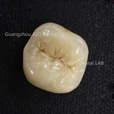 China China Dental Lab Full Metal Pfm Crowns and Bridges 3D Digital for Dental Clinics for sale