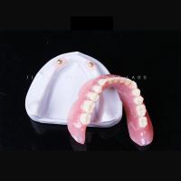 China MK1 Precision Milled Dental Precision Attachments With Acrylic Teeth for sale