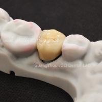 China Metal Ceramic Crowns Custom Fixed Prosthesis Pfm Long Bridge 3D Laser Printing for sale