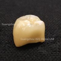 China Porcelain Metal Crowns Fixed Denture Restorations Metal Pfm Custom China Dental Lab for sale