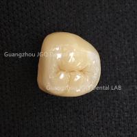 China Porcelain Metal Crowns Fixed Denture Restorations Metal Pfm Custom China Dental Lab for sale