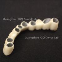 China Teeth Pfm Crowns Porcelain Fused To Metal Crown Cobalt Chrome Alloy for sale