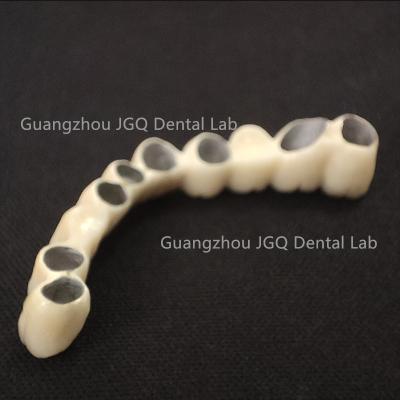 China Teeth Pfm Crowns Porcelain Fused To Metal Crown Cobalt Chrome Alloy for sale