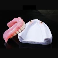 China Custom Removable Dentures Complete Acrylic Teeth Precision Titanium Bar China Dental Lab for sale