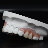 China Customized Flexible Valplast Denture from China Dental Lab for sale