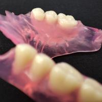 China Valplast Flexible Denture Invisible Base Similar Natural Gum Color Persistent Color Change for sale