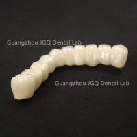 China Dental Pfm Crown and Bridge Restorations for Dental Care China Dental Laboratory for sale