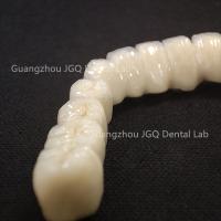 China Dental Pfm Crown and Bridge Restorations for Dental Care China Dental Laboratory for sale